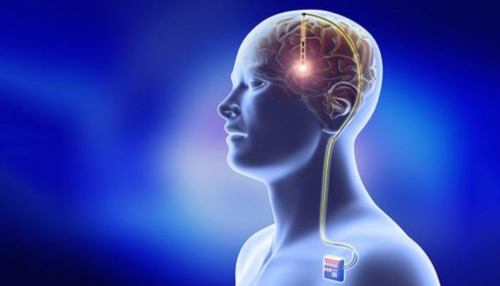 Remote monitoring and brain wave altering