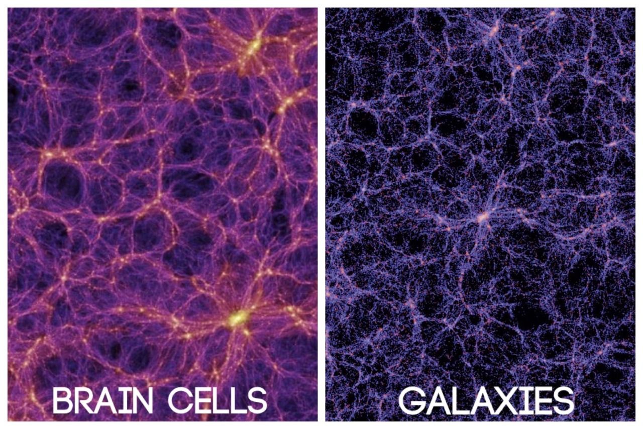 The universe as like human brain